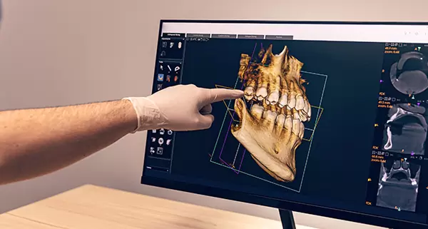 Los Avances Revolucionarios en Odontología para 2025: Tecnología y ...