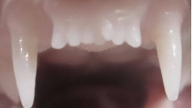 Tratamiento que regenera los dientes perdidos - CORVT